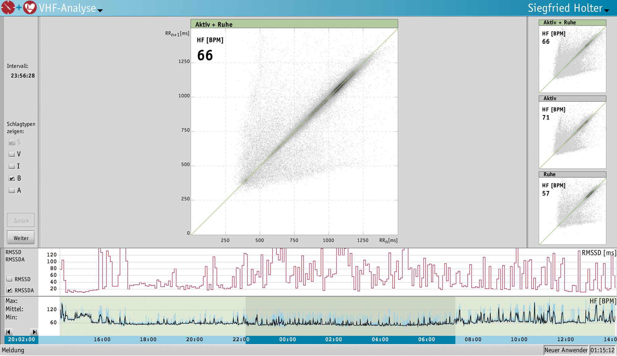 Langzeit-EKG-VHF-Analyse - Medset