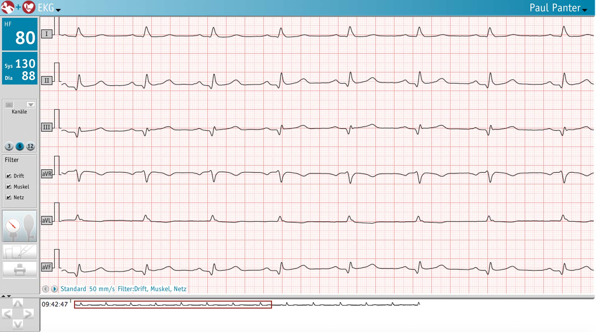 Ruhe-EKG-1 - Medset