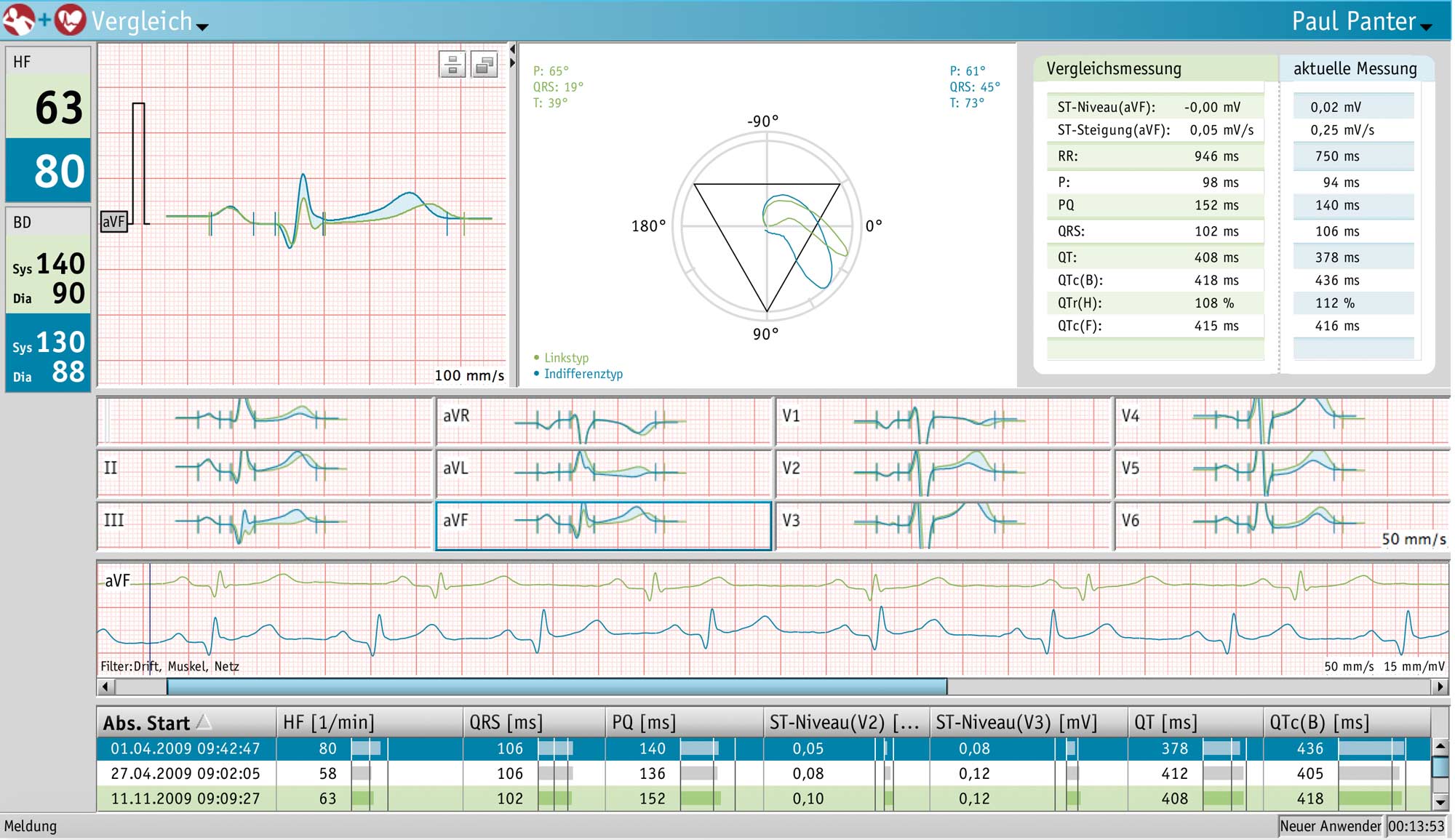 Ruhe-EKG-2 - Medset